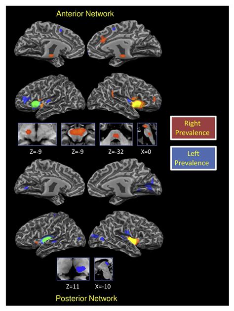 Figure 1 From Functional Connectivity Of The Insula In The Resting Brain Semantic Scholar