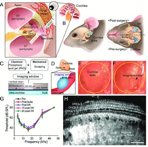 Surgical Approach For Generating An Iw For In Vivo Imaging Of Cochlear Download Scientific