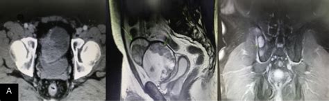 Computed Tomography Ct And Magnetic Resonance Imagining Mir Download Scientific Diagram