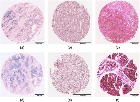 Super Resolution Recurrent Convolutional Neural Networks For Learning