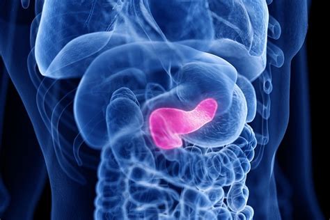 Main Pancreatic Duct Dilation Ups Odds For Neoplastic Progression