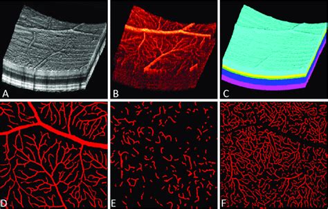 Representative Dataset A Oct Data Volume B Octa Data Volume C Download Scientific
