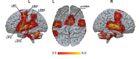 figure 1 from neural basis of sensorimotor plasticity in speech motor
