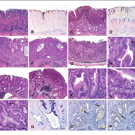 Gastric Histopathology Scores For All Mice At 6 12 And 15 Months Download Scientific Diagram