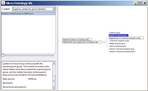 slicer3 module queryatlas slicer wiki