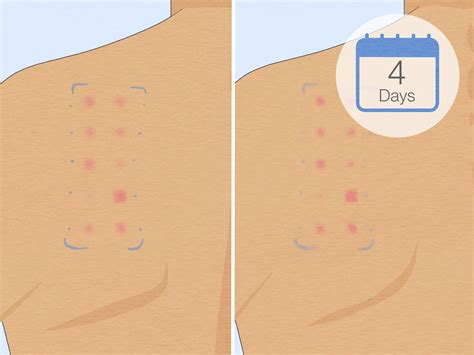 7 Simple Steps For Patch Testing A New Cosmetic Or Skincare Product