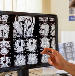 GoodTherapy Sex Addiction And Drug Addiction Show Simil