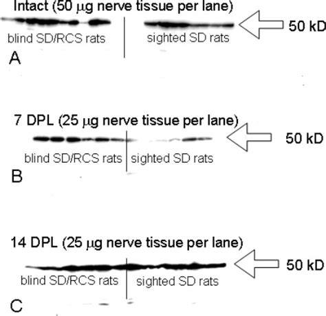 Staining With The Polyclonal Antibody Recognizing Neuronal Class Iii Download Scientific