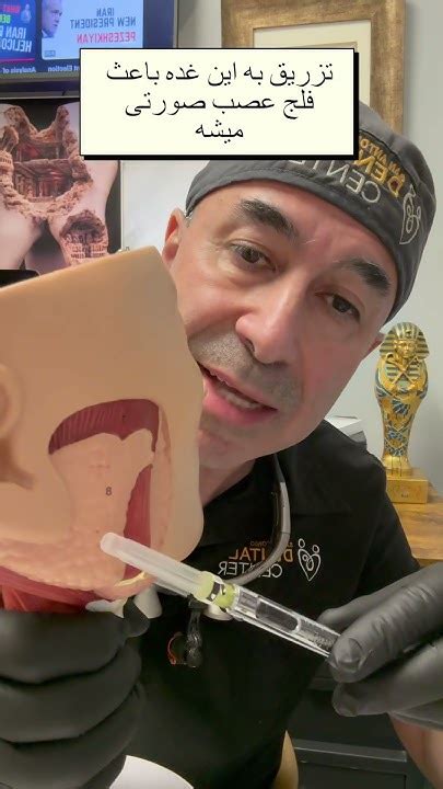 اسيب به عصب صورتفلج عصب صورت Youtube