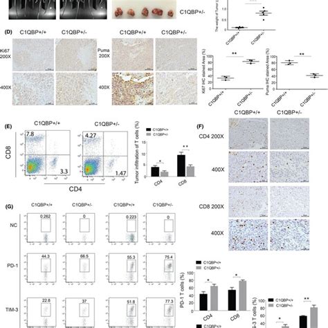 Complement C1q Binding Protein C1QBP Knockdown Impacts Tumor Download Scientific Diagram