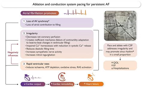 The Heart 🔴atrioventricular Node Ablation For Atrial