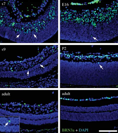 Rgc Differentiation In T Occidentalis Brn3a Immunoreactivity In Mole