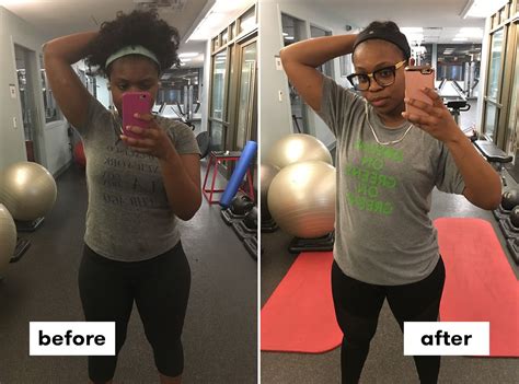 I Tried Botox For Sweating And Havent Used Antiperspirant For Months Self