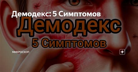 Демодекс: 5 Симптомов | АбсурдоЗавр | Дзен