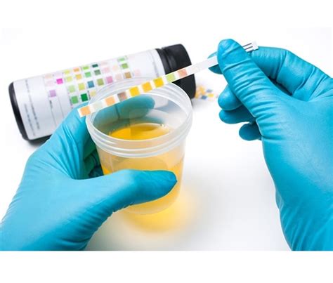 Urine Analysis آزمایشگاه وحید