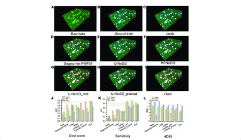 A I Visualization Of Comparing The Results Of Different Segmentation Download Scientific