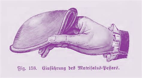 The Evolution Of Womens Birth Control Ancient To Modern Contraception