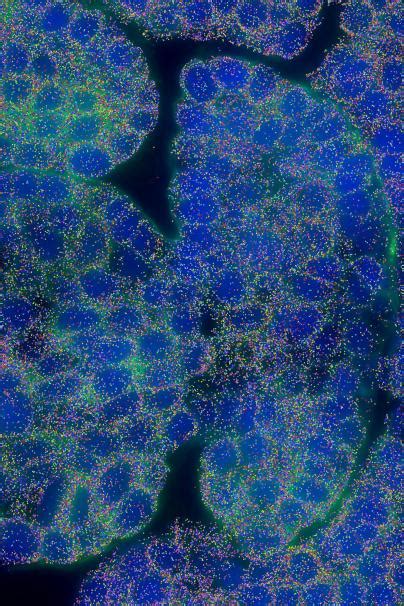 How To Use Spatial Transcriptomics To View Single Plant Cells In Situ Earlham Institute