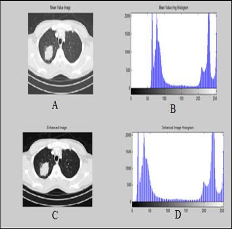 Figure 1 From Lung Cancer Detection Using Image Processing Semantic Scholar