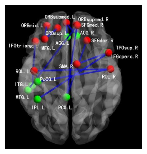 Decreased Functional Connectivity Related With Frontal Lobes In Esrd