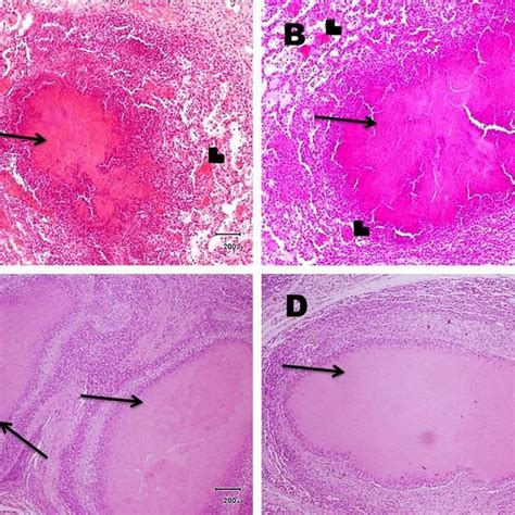 Aandb Gross Appearance Of Liver Abscesses In Cattle Arrows C A Download Scientific Diagram