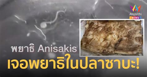 พยาธิในปลาซาบะ รวมข่าวของ พยาธิในปลาซาบะ อัพเดตเรื่อง พยาธิในปลาซาบะ
