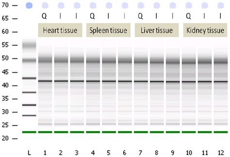 Rna Isolation Purification From Frozen Mouse Liver Tissue Itri I Download Scientific Diagram