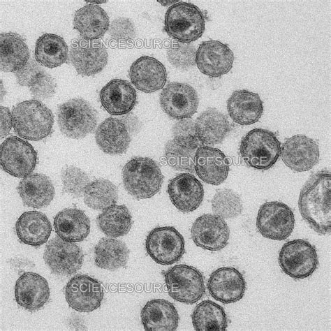 Photograph Siv Particles Tem Science Source Images