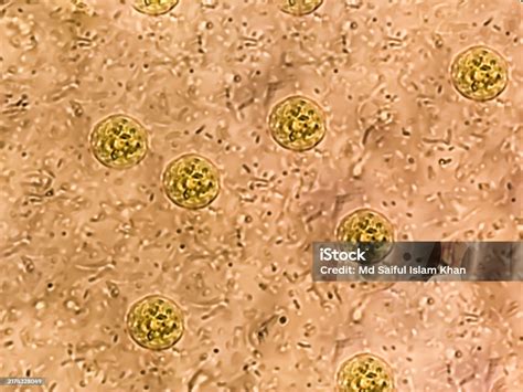 Photo Libre De Droit De Microscopic View Of Stool Sample Showing Cyst
