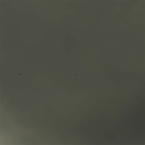 Sperm Tracking Object Detection Dataset By Dongwon Kim