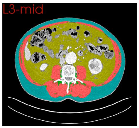 Example Of Automated Tissue Segmentation At The L3 Vertebral Level