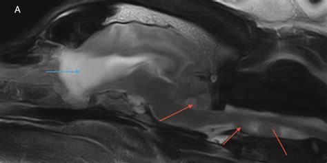 Metastatic Intracranial Choroid Plexus Tumours Hallmarq Veterinary Imaging Metastatic Intracranial Choroid Plexus Tumours Hallmarq Veterinary Imaging