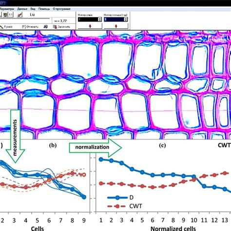 Measurements And Initial Processing Of Anatomical Parameters