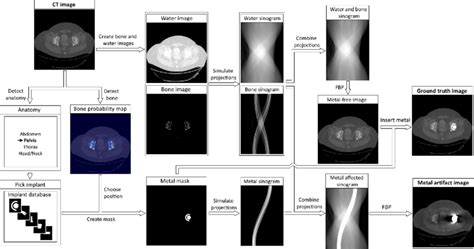Simulation Of Metal Artifacts Download Scientific Diagram