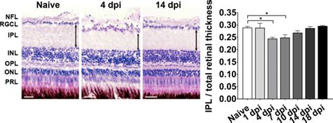 Ipl Thinning And Restoration Suggests Dendritic Shrinkage And