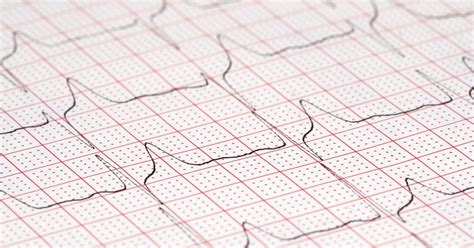 Mind The Bleep On Linkedin Hyperkalaemia