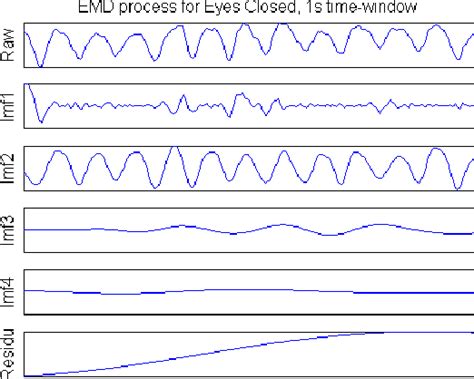 Figure 1 From Classification Of Wheelchair Commands Using Brain