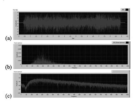 Figure 1 From An Emg Instrument Designed For Bruxism Detection On Masseter Muscle Semantic Scholar