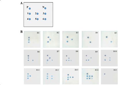Detection And Typing Of Ndv Ibv Or Aiv Using Oligonucleotide Download Scientific Diagram