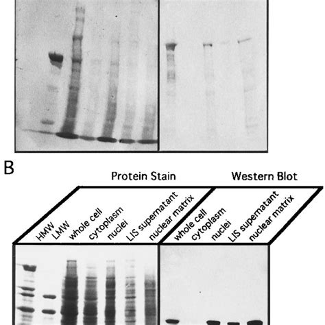 Western Blot Analysis Of Subcellular Fractions From Hela Cells A