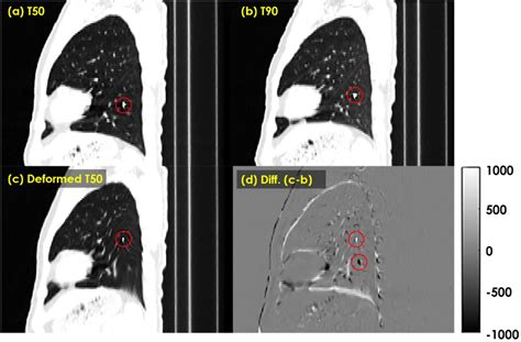 Sample Outlier Results Deformed By The Fast Demons Algorithm Algorithm Download Scientific