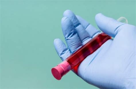 ექიმმა სალამატინამ დაასახელა დაავადებები რომელთა გამოც ხდება