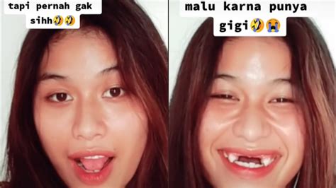 Viral Pesona Widya Ulfa Seleb Tiktok Gigi Ompong Yang Parasnya Cantik Banget