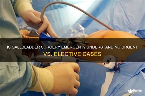 Is Gallbladder Surgery Emergent Understanding Urgent Vs Elective