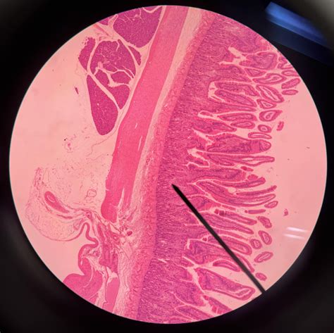 Jejunum Diagram Quizlet