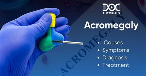 Acromegaly Causes Symptoms Diagnosis Treatment And More