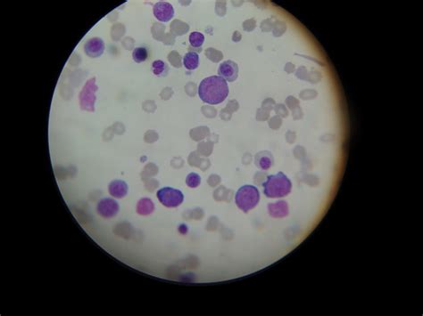 Proeritroblasto Eritroblasto Basofilico Eritroblasto Ort Flickr