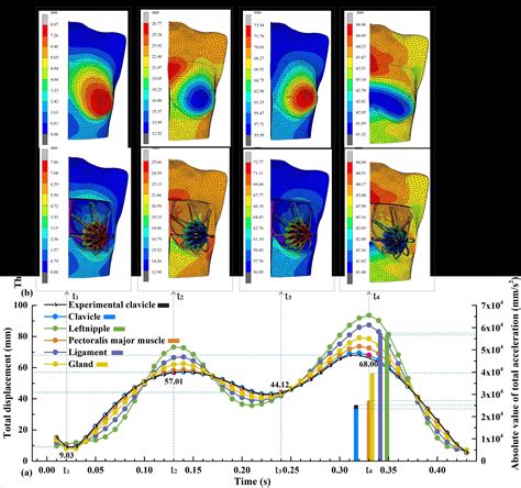 Construction Of Multi Component Finite Element Model To Predict