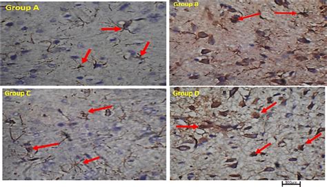 Representative Photomicrograph Of The Prefrontal Cortex Pyramidal Cell Download Scientific