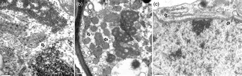 Transmission Electron Micrographs Of Ultrathin Sections Of Symptomatic